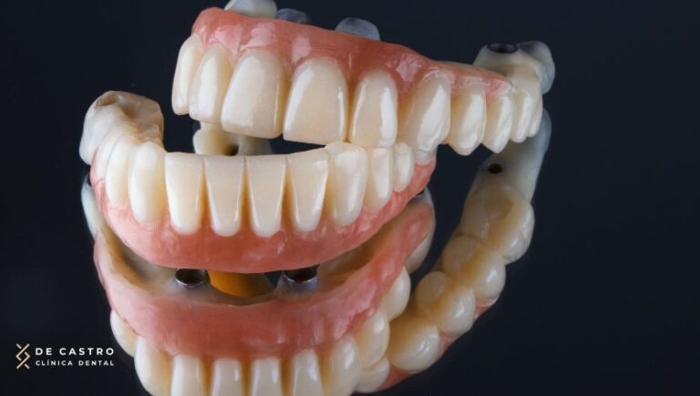 Los 6 tipos de cirugía maxilofacial - De Castro